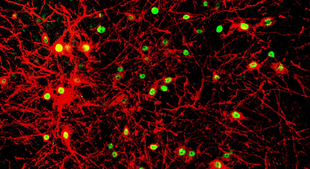 How diversity is driving insights into the brain