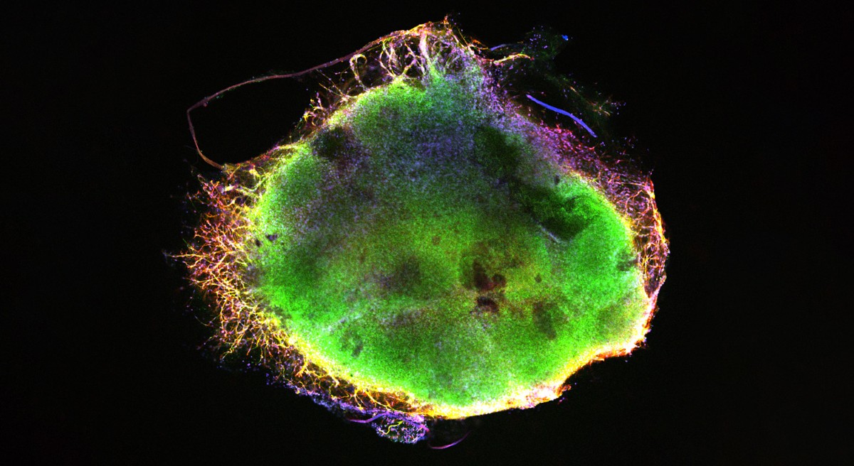 Testing toxicity using stem cells and AI