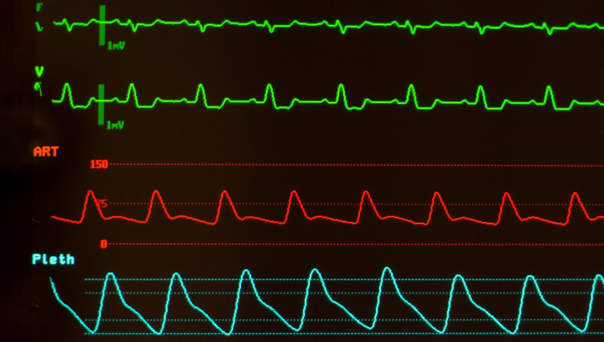 The changing face of heart monitoring