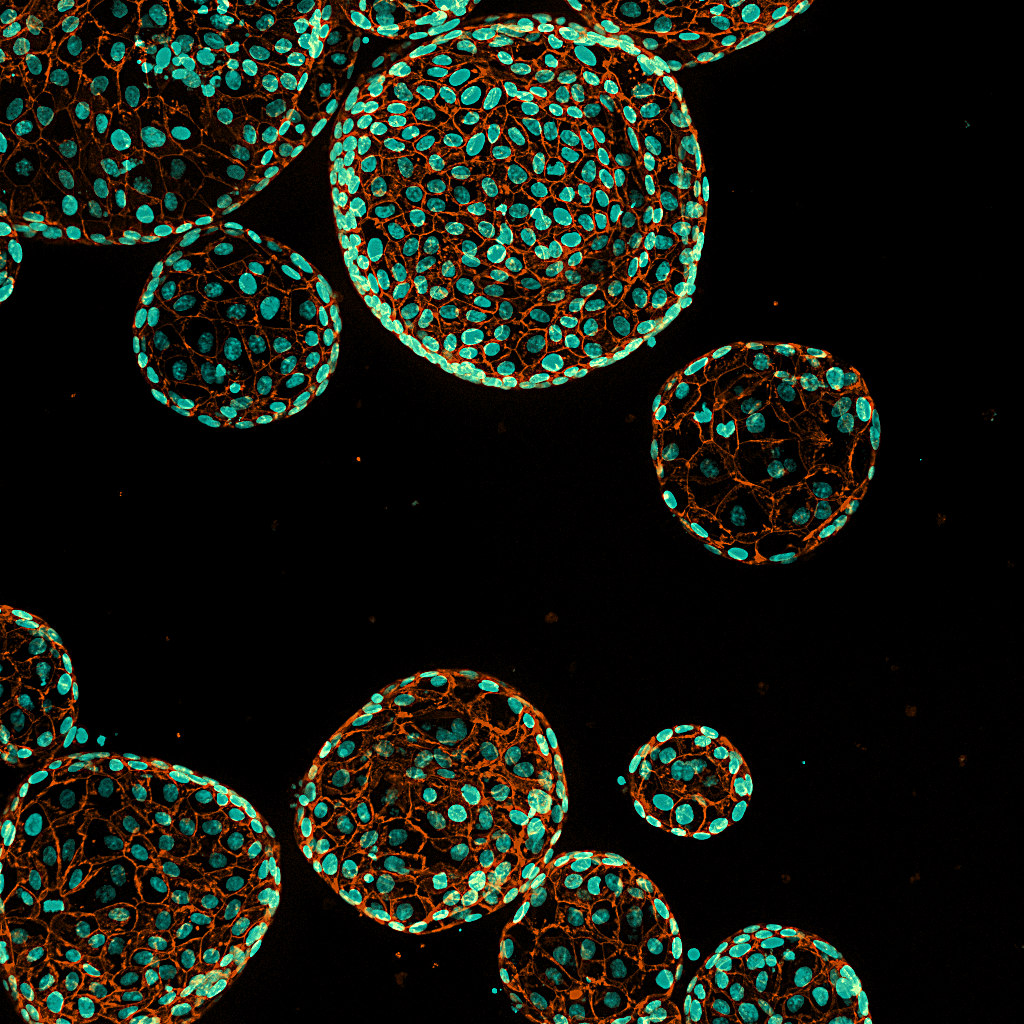 Beyond animal models: how organoids could transform drug development