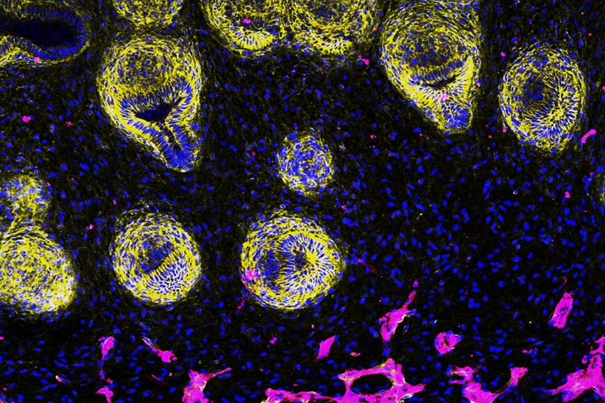 Organoid science is more than skin deep