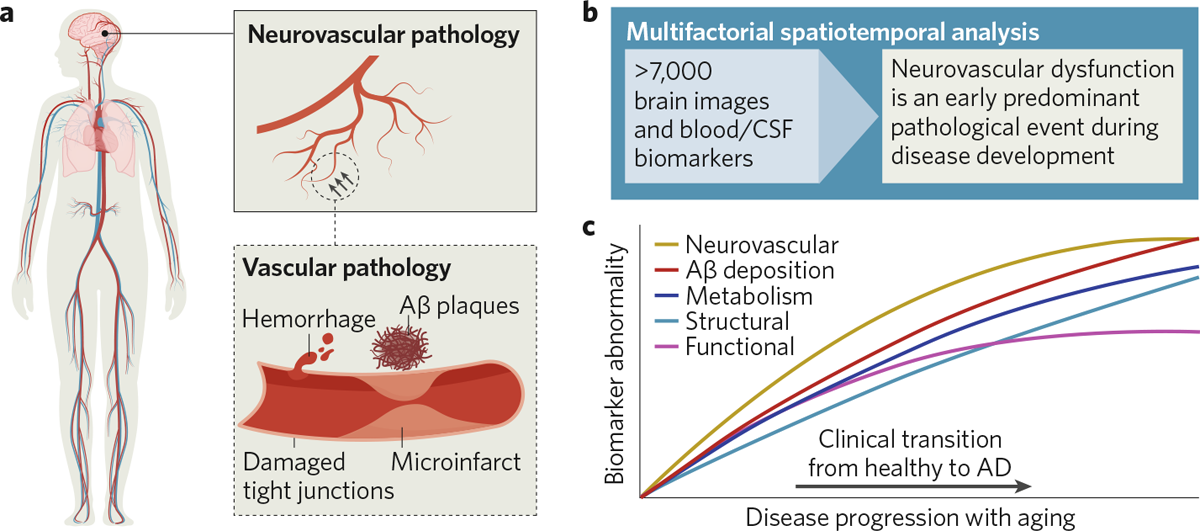Deciphering the enigma of brain disease