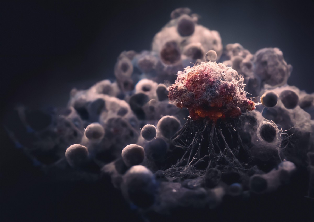Nanoformulation ferries cancer treatment to combat drug-defying tumours