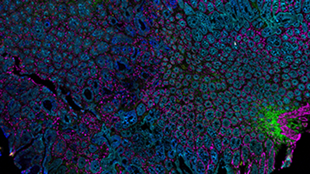 Multimodal tissue imaging and machine learning to advance precision ...