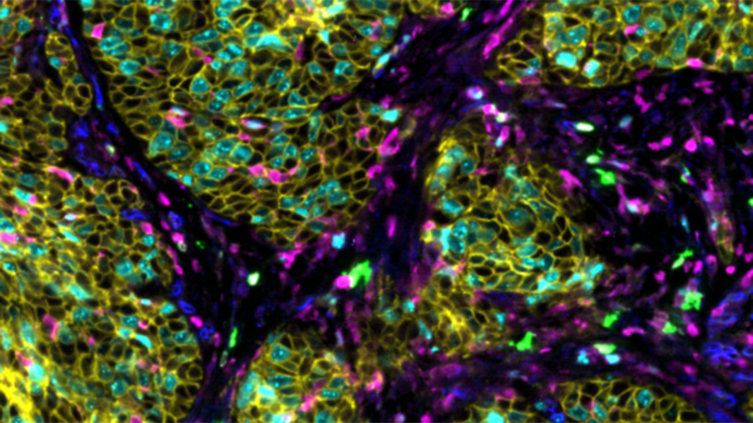 From images to insights: deep spatial phenotyping reveals disease and ...