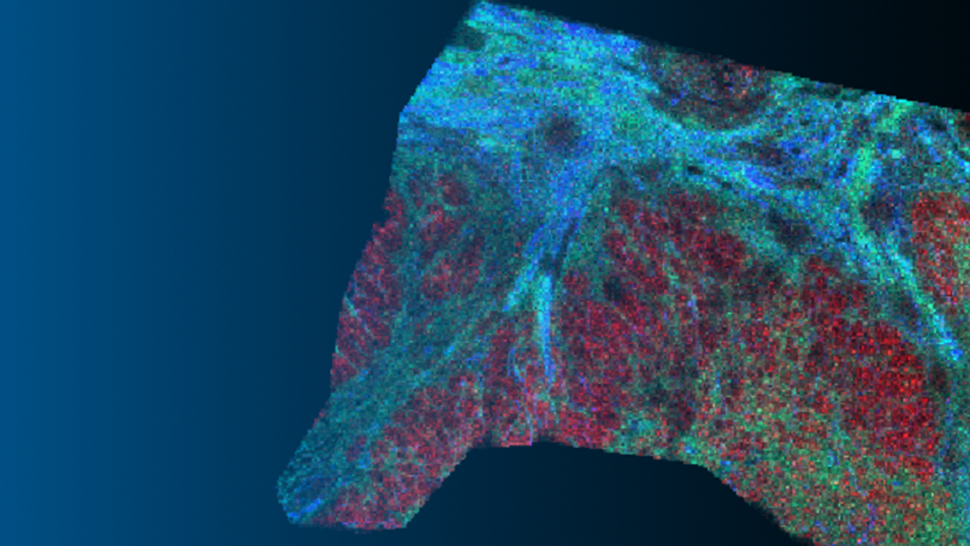 Adding a molecular dimension to pathology with mass spectrometry imaging