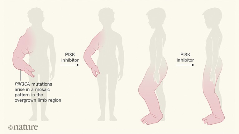Lessons for cancer drug treatment from tackling a non-cancerous ...