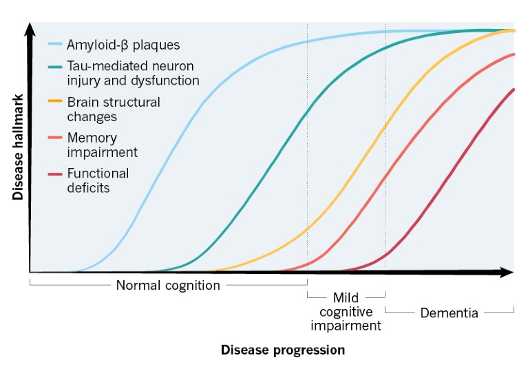 An age-old story of dementia