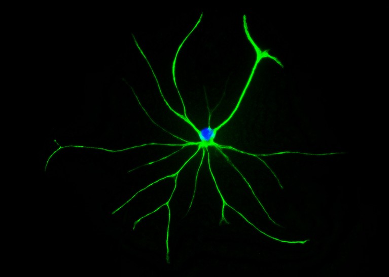 Tapping into the brain’s star power