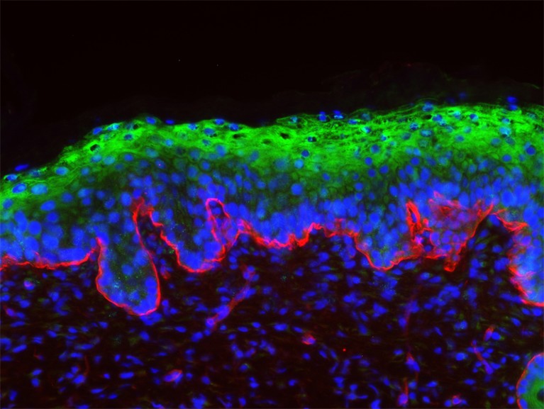 Change the genes to fix the skin