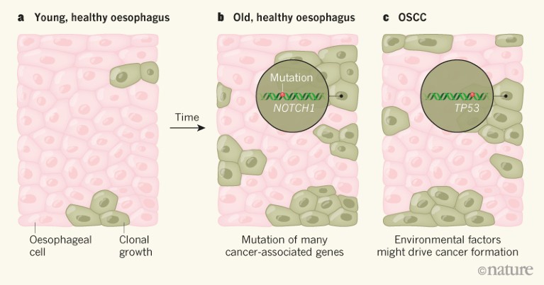 Mutations differ in normal and cancer cells of the oesophagus