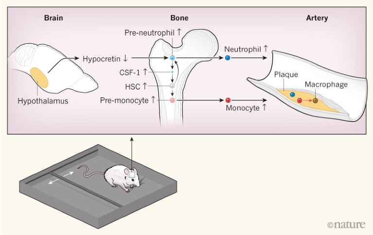 How broken sleep promotes cardiovascular disease