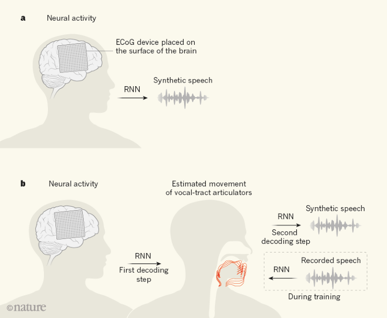Brain implants that let you speak your mind