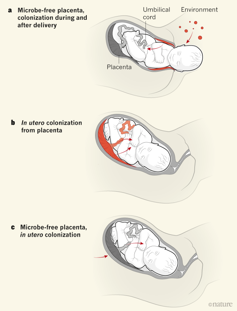 No bacteria found in healthy placentas