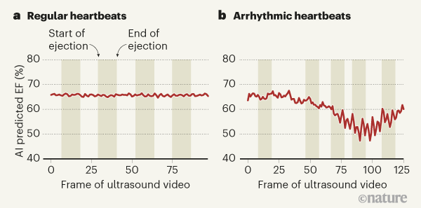 AI tracks a beating heart’s function over time