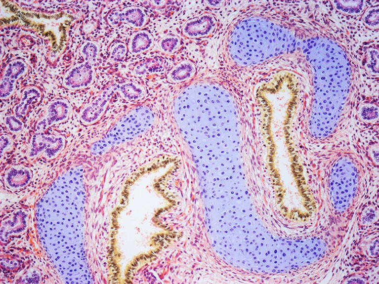 Africa’s vaccine revolution, fetal-tissue studies and infection protection