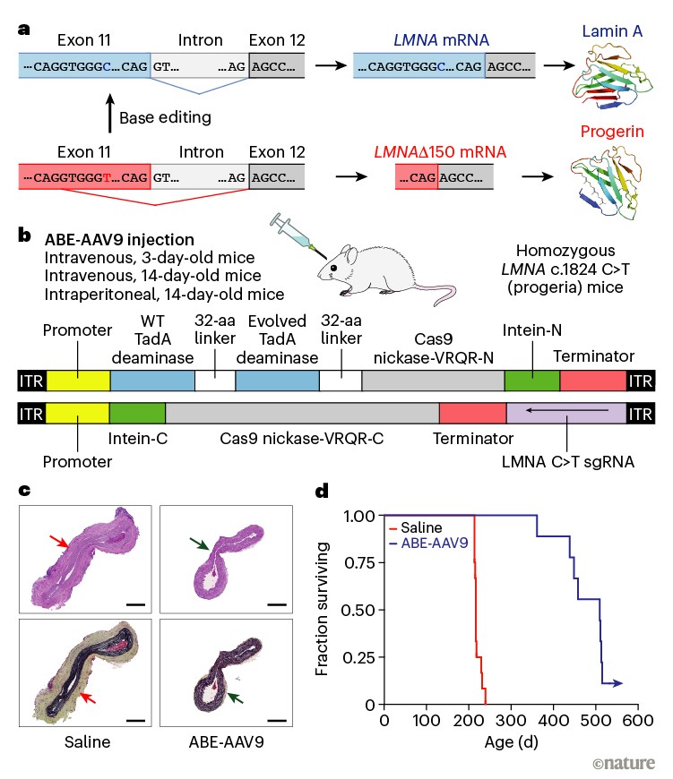 Base editor treats progeria in mice