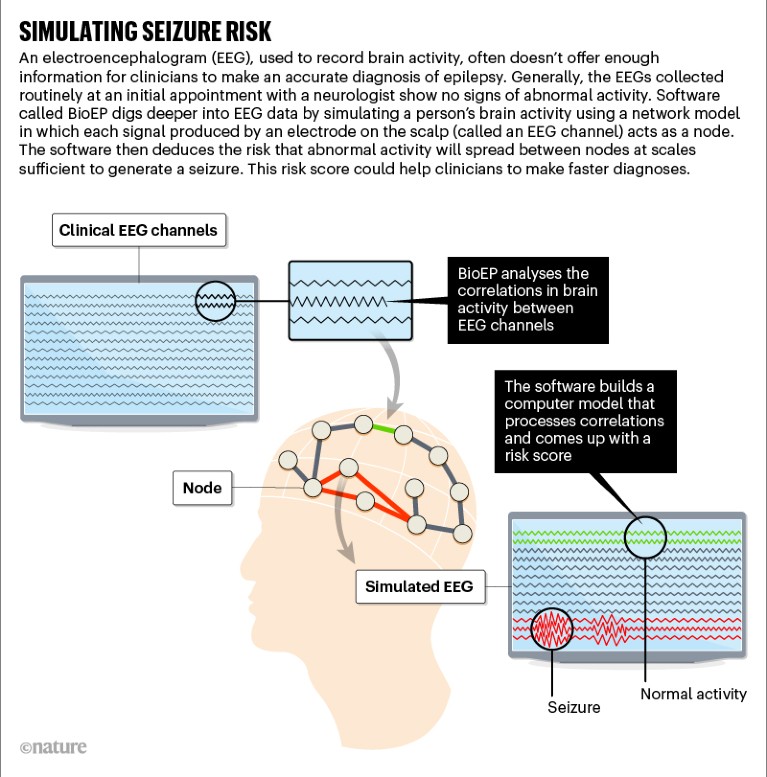 Accelerating the diagnosis of epilepsy with computer modelling