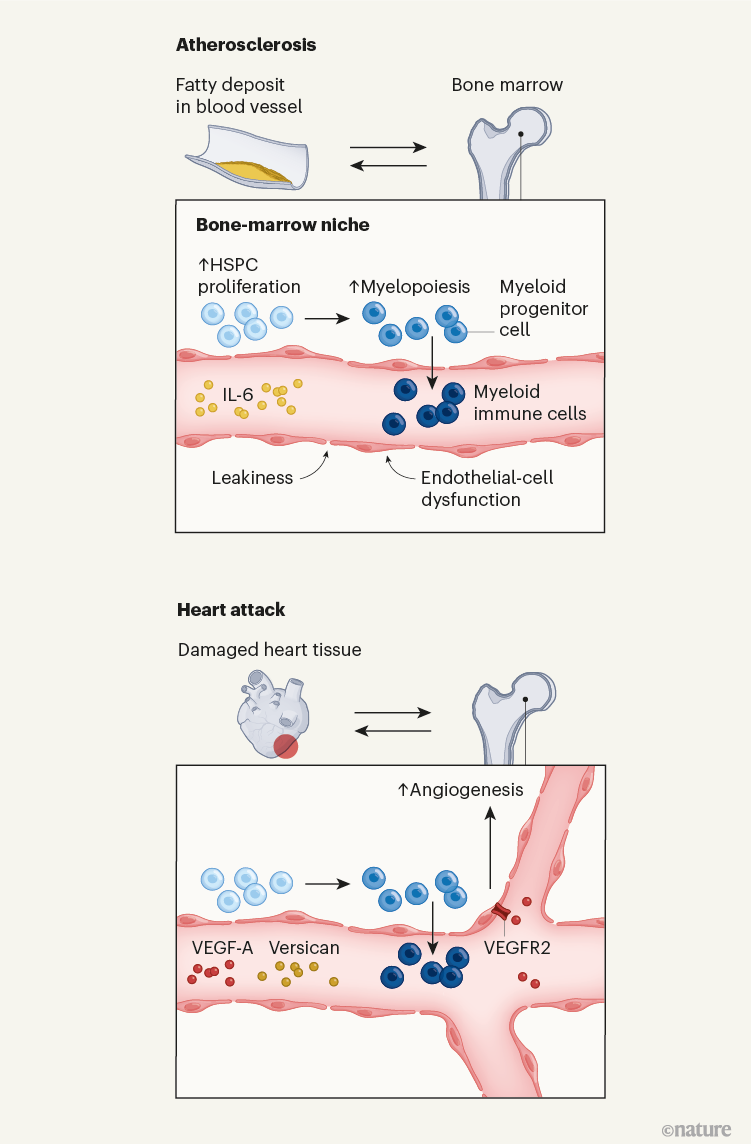 Cardiovascular diseases disrupt the bone-marrow niche