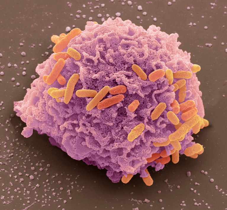 The staggering death toll of drug-resistant bacteria