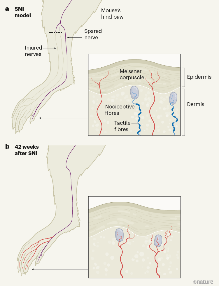 Nerve regrowth can be painful