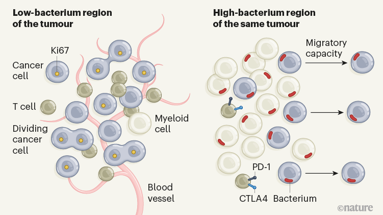 A spatial perspective on bacteria in tumours