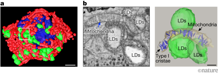 Diversity of mitochondrial networks in lung cancer imaged