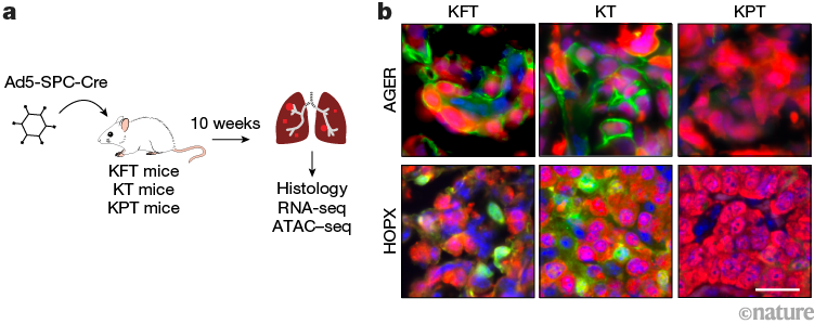 Tissue-regeneration program underlies lung-cancer suppression