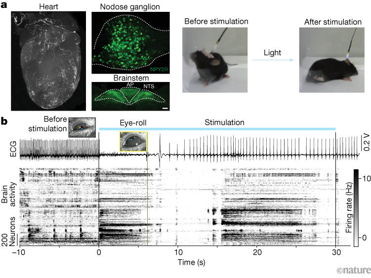 Identification of neuronal connections between heart and brain that ...