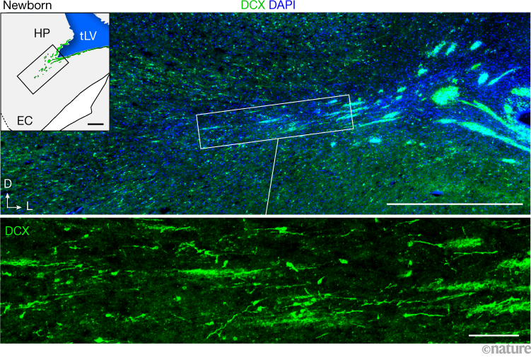 Neuron migration to brain regions key to memory and navigation ...