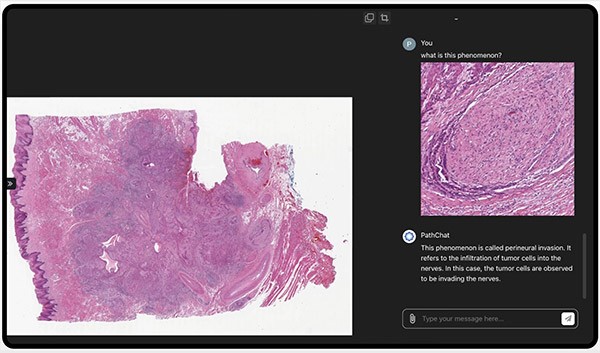 AI & robotics briefing: Pathology chatbot can diagnose disease and talk ...