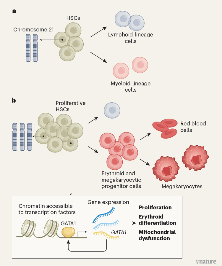 Childhood leukaemia in Down’s syndrome primed by blood-cell bias