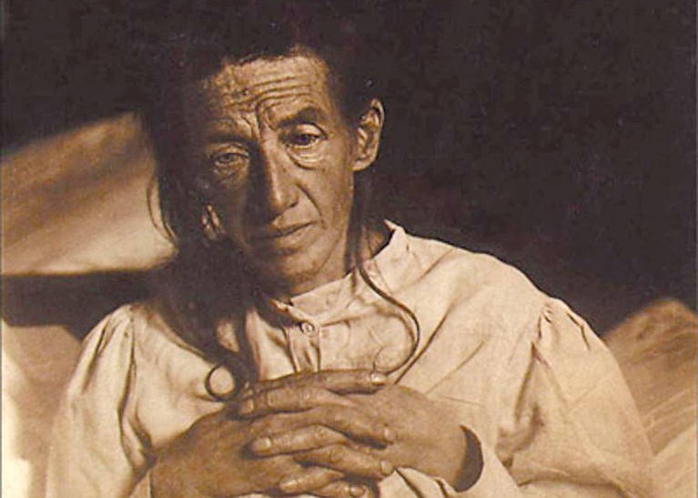 1906: The dawn of Alzheimer’s disease