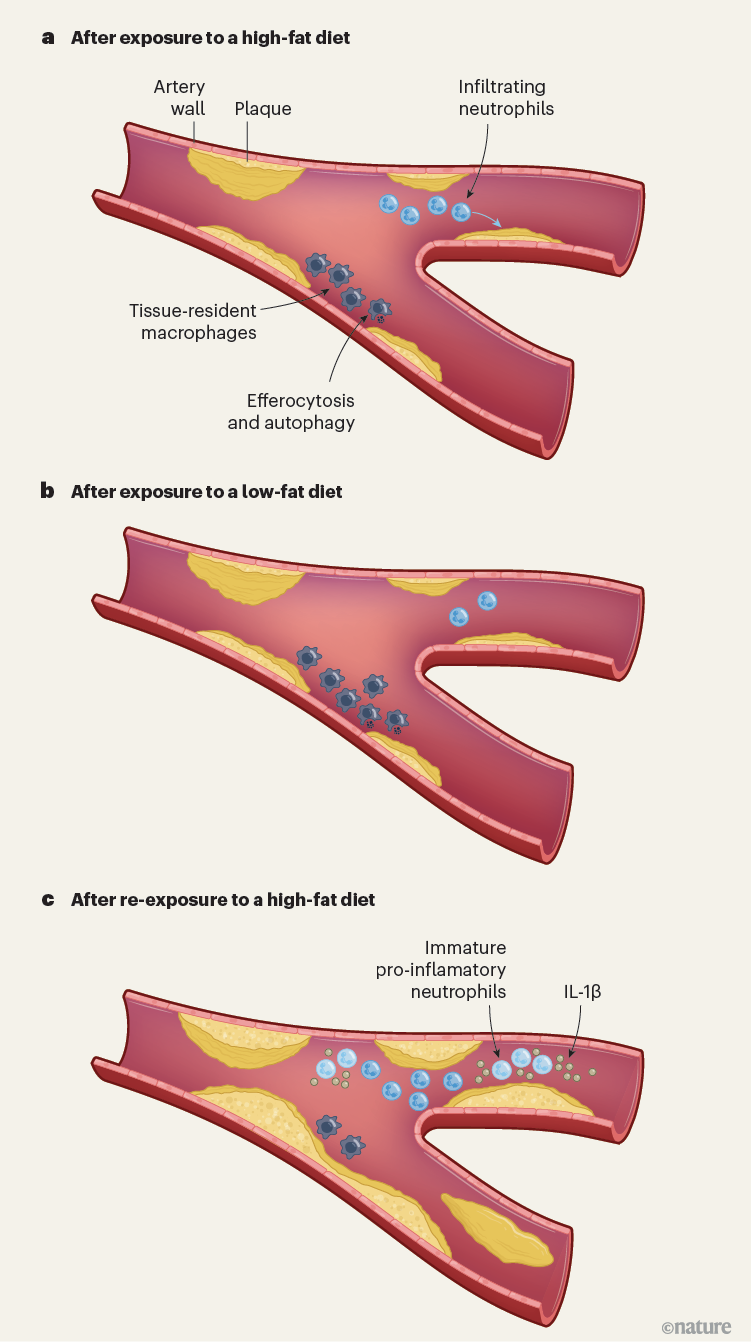 Yo-yo dieting accelerates cardiovascular disease by reprogramming the ...
