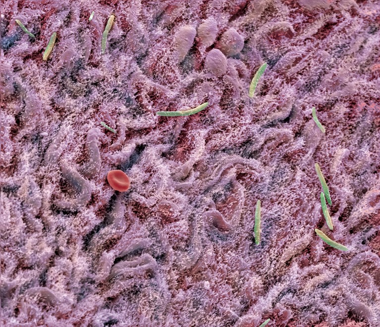 How to fix a gut microbiome ravaged by antibiotics