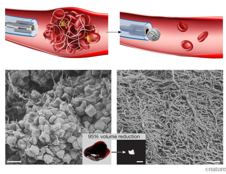 Tiny rotating device puts a new spin on blood-clot removal