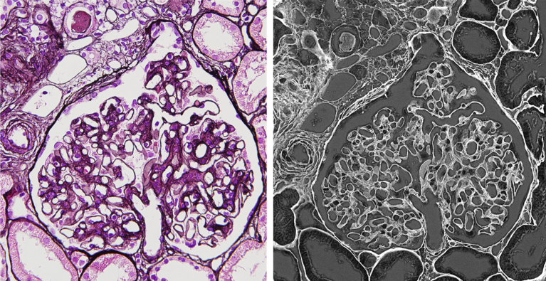 Different microscopy offers new insights to kidney disease