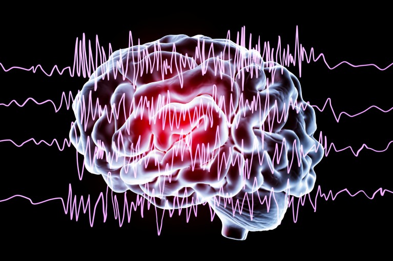 The psychological challenges of epilepsy