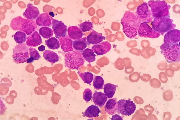 Accelerating leukaemia treatment efficacy and access