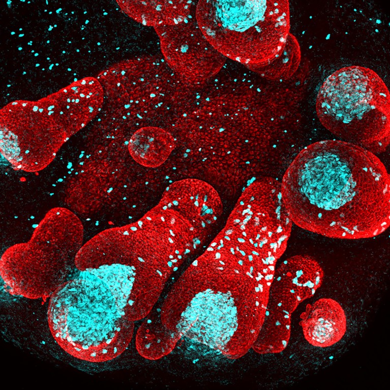 Hair growing skin produced from human stem cells