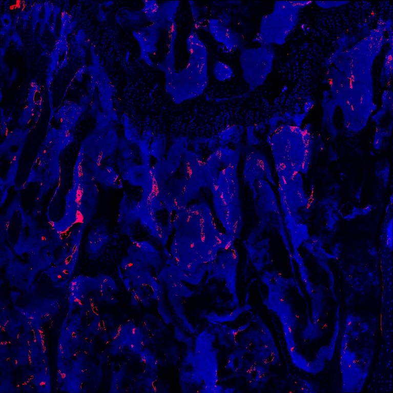 Building knowledge and Strength in orthopaedics