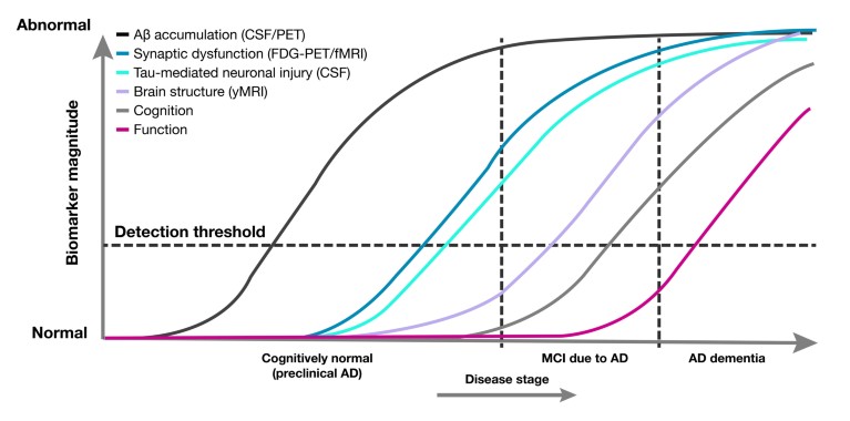 Alzheimer’s disease: more than just plaque