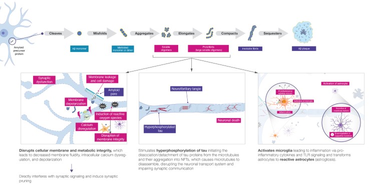 Alzheimer’s disease: more than just plaque