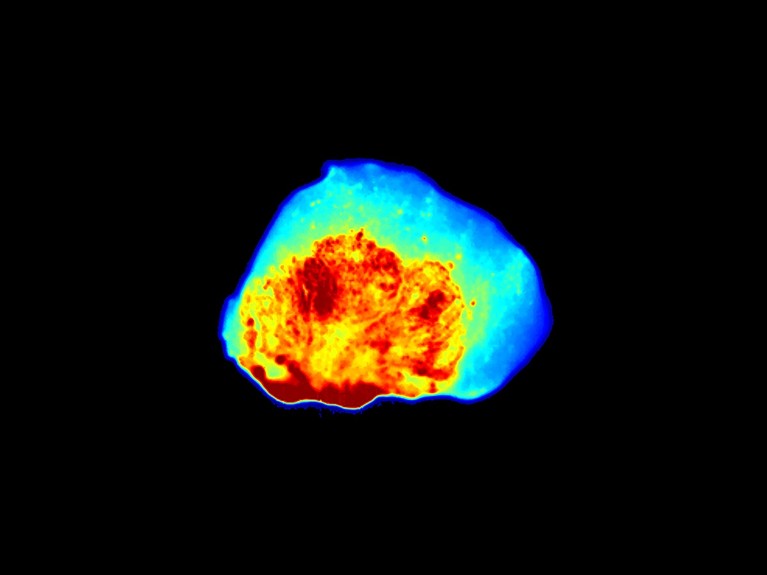 Detecting and treating cancers with precision