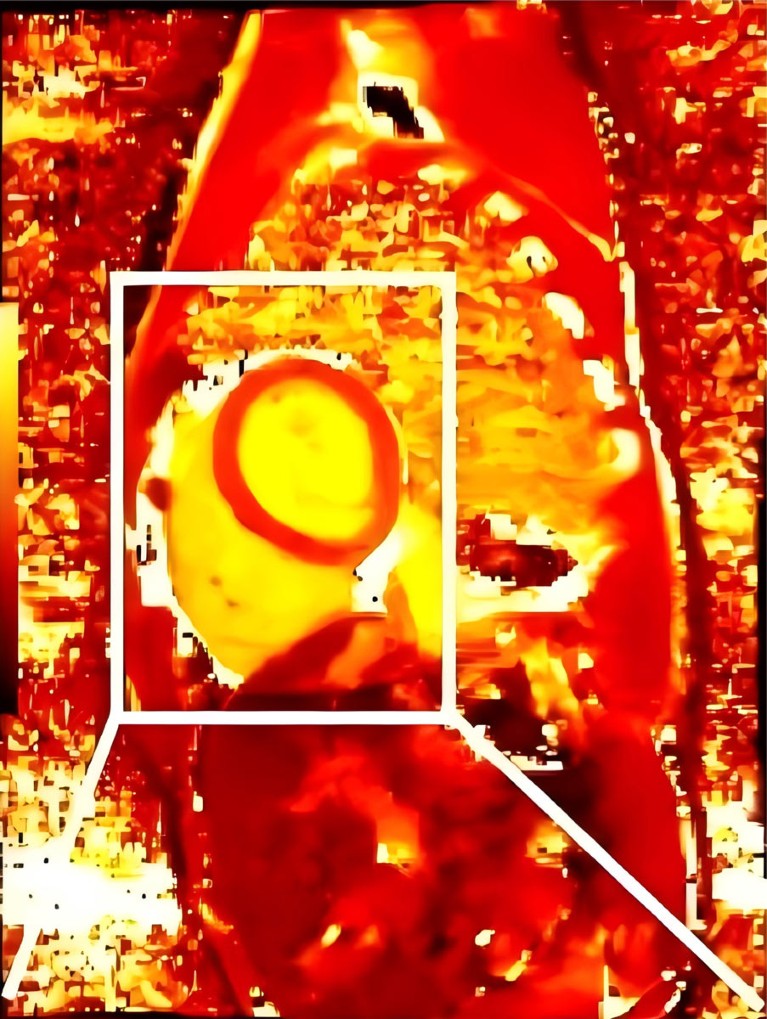 Helium free MRI scanners sidestep a global problem