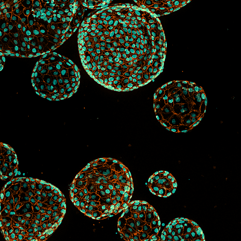Beyond animal models: how organoids could transform drug development