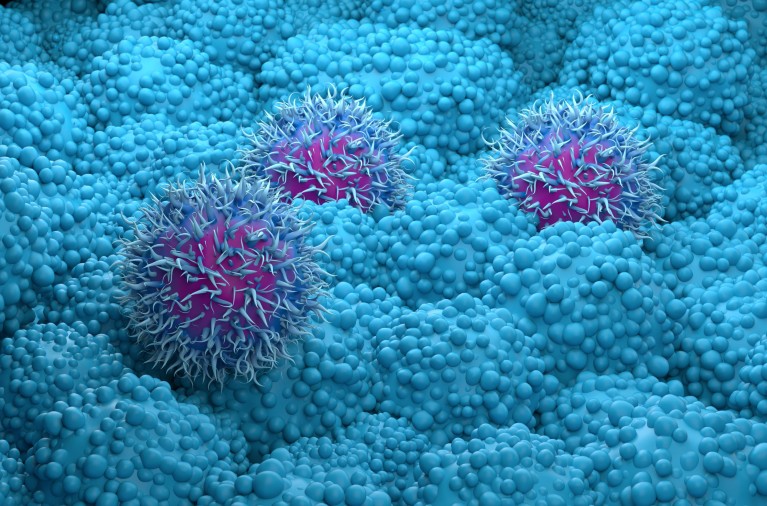 Pancreatic cancer’s complexity drives clinical innovation