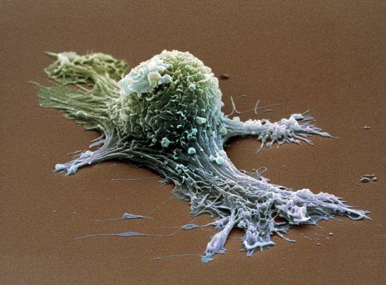 Il Pap test potrebbe essere usato per la diagnosi precoce del cancro ...