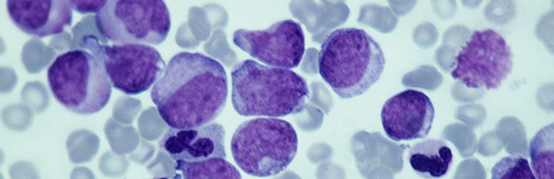 Unlocking the power of genomic testing in haematological malignancies