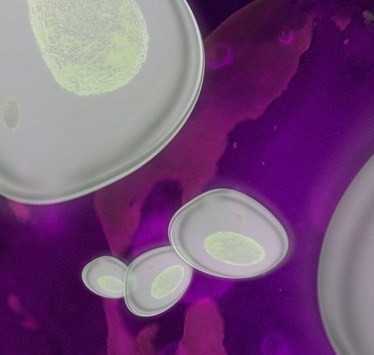 Indian roots of malaria parasite